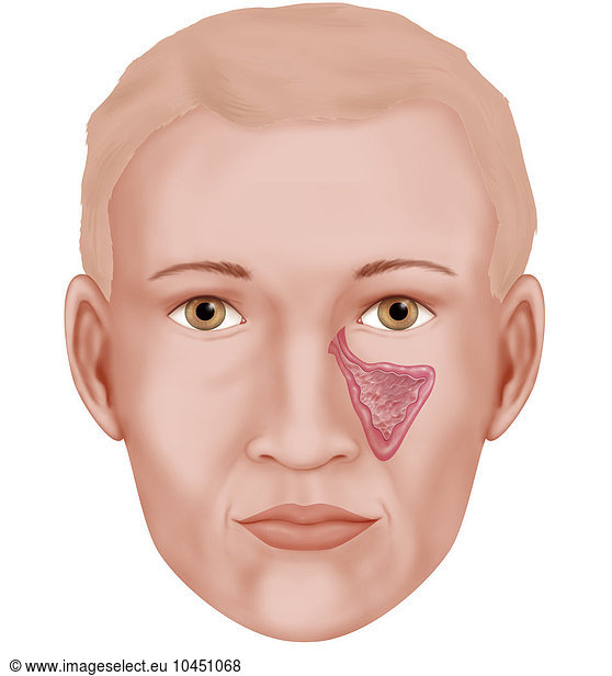 A Cross Section Illustration Of The Left Maxillary Sinus A Cross