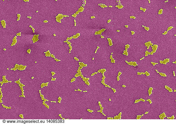 Acinetobacter baumannii Bacteria Acinetobacter baumannii Bacteria, SEM ... Acinetobacter baumannii Bacteria Acinetobacter baumannii Bacteria, SEM ...