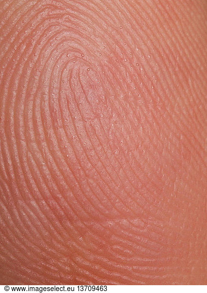Close Up Of A Finger Showing The Loop Pattern In The Skin Ridges This Pattern Is Used In
