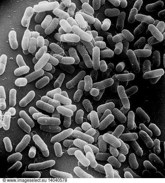 E Coli Bacteria E Coli Bacteria Sem Abnormal Abnormality Cytopathological Rights Managed