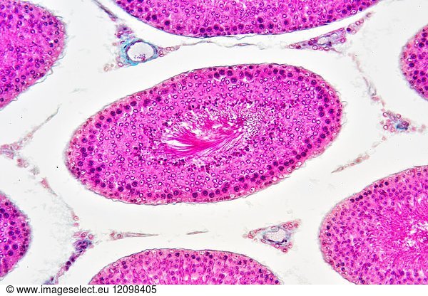 Human Testicle Or Testis Section Showing Seminiferous Tubules Human